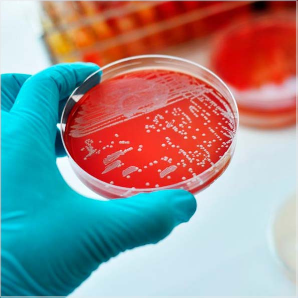 Target Normas: Como realizar os exames microbiológicos produtos